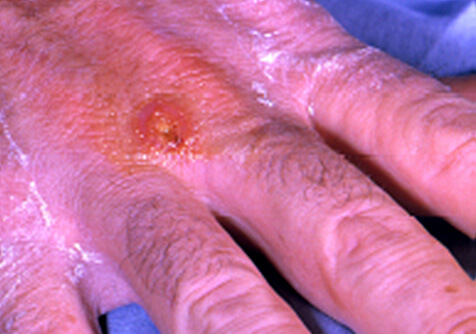 Bioterrorism and Weapons of Mass Destruction | Nursing Ceu | CEUfast